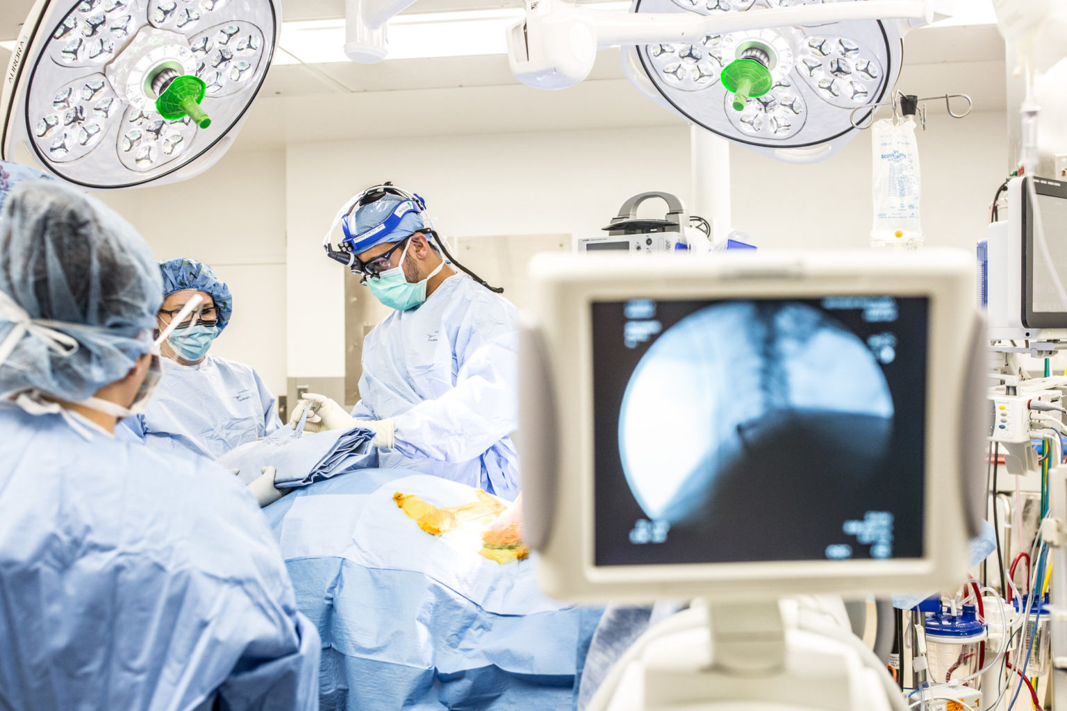 Failed Back Surgery Syndrome